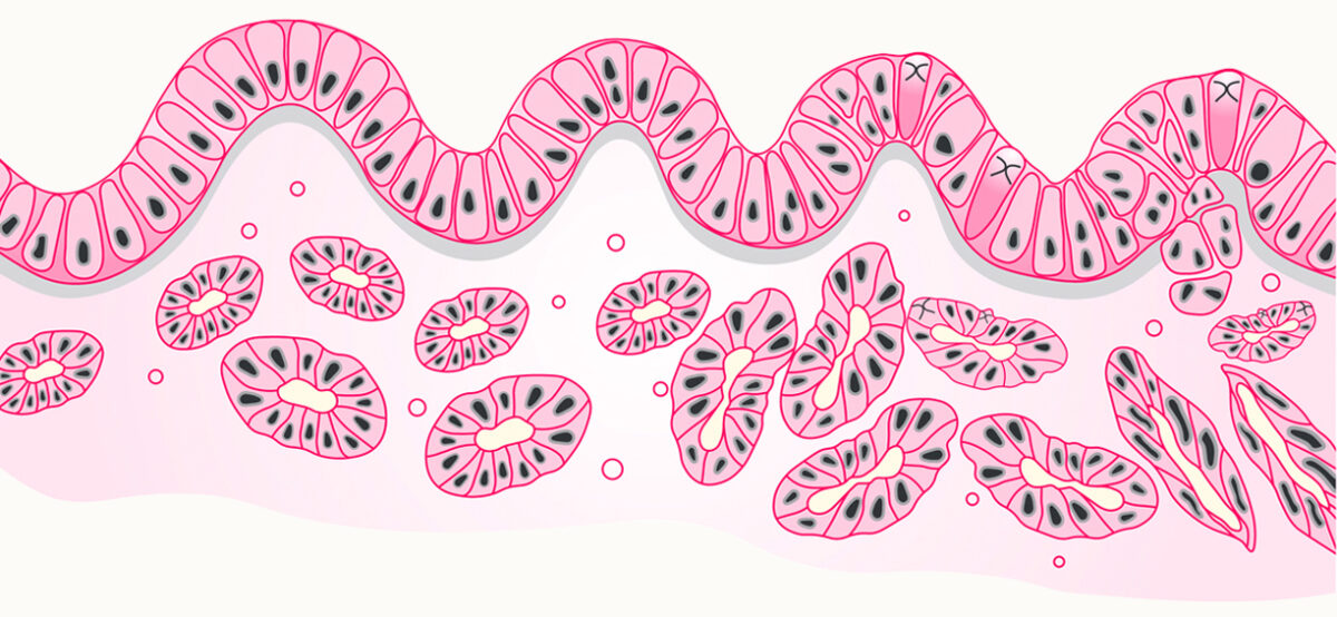 Ik krijg hiervoor behandeling - Barrett